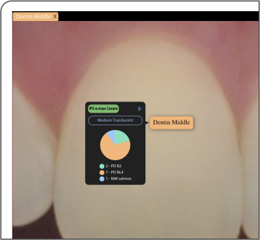 Shade Matching made Easy with Matisse
