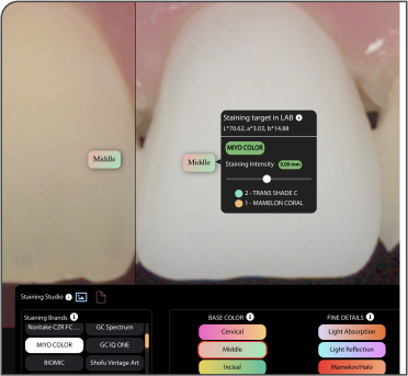 Shade Matching made Easy with Matisse