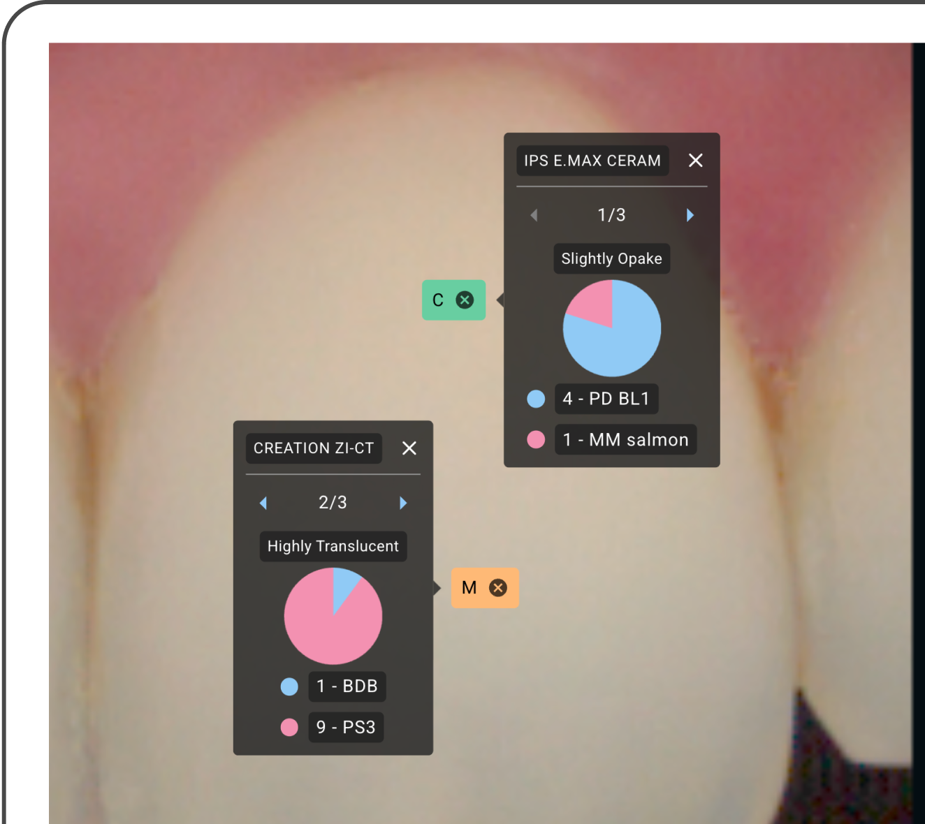 Shade Matching made Easy with Matisse